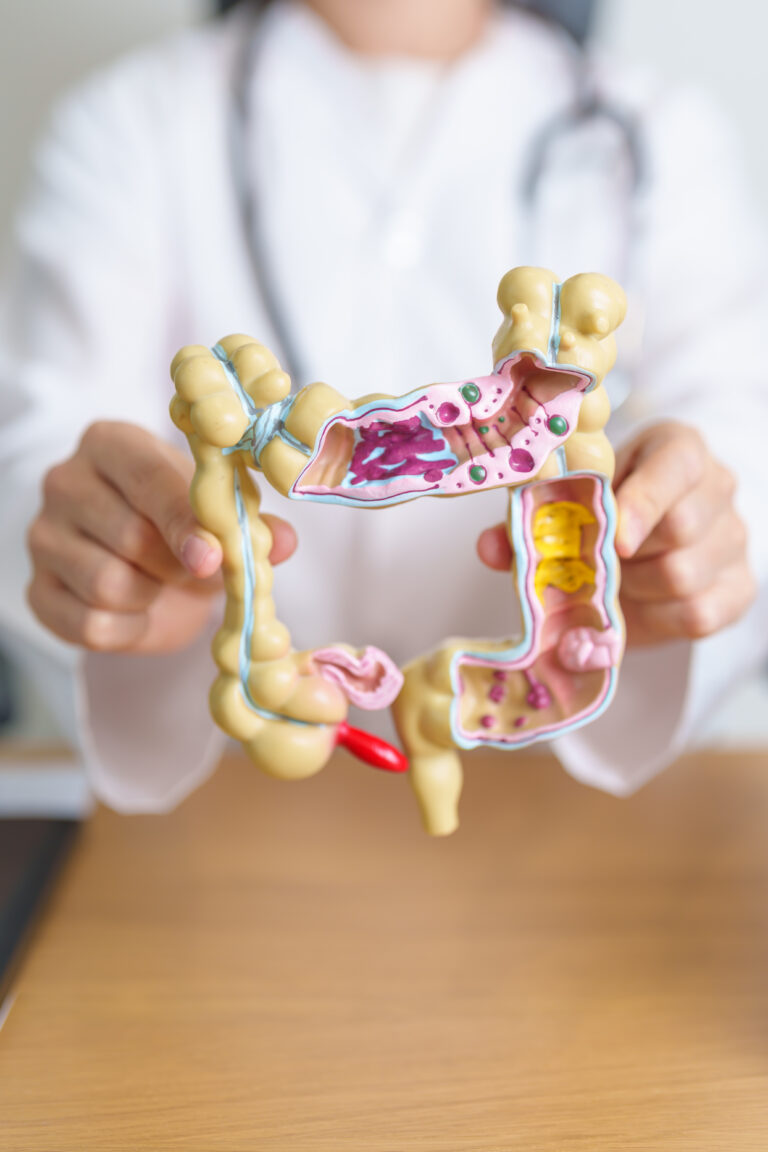Coloproctología Adulto — Clinica Nace